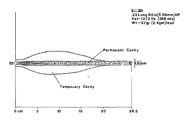 Calculating Permanent Cavity Wound Mass from Fackler Wound Profiles