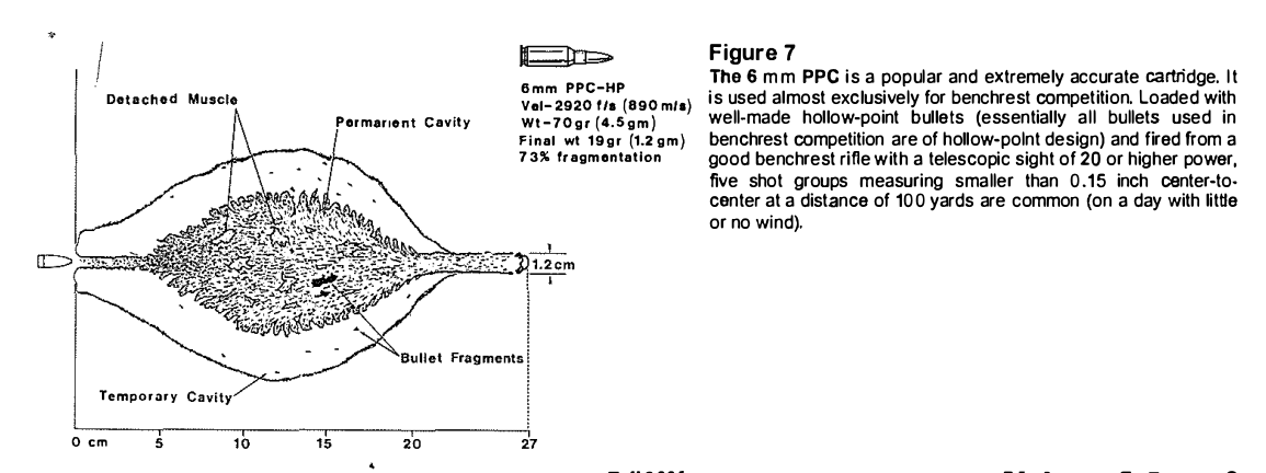 Calculating Permanent Cavity Wound Mass from Fackler Wound Profiles ...